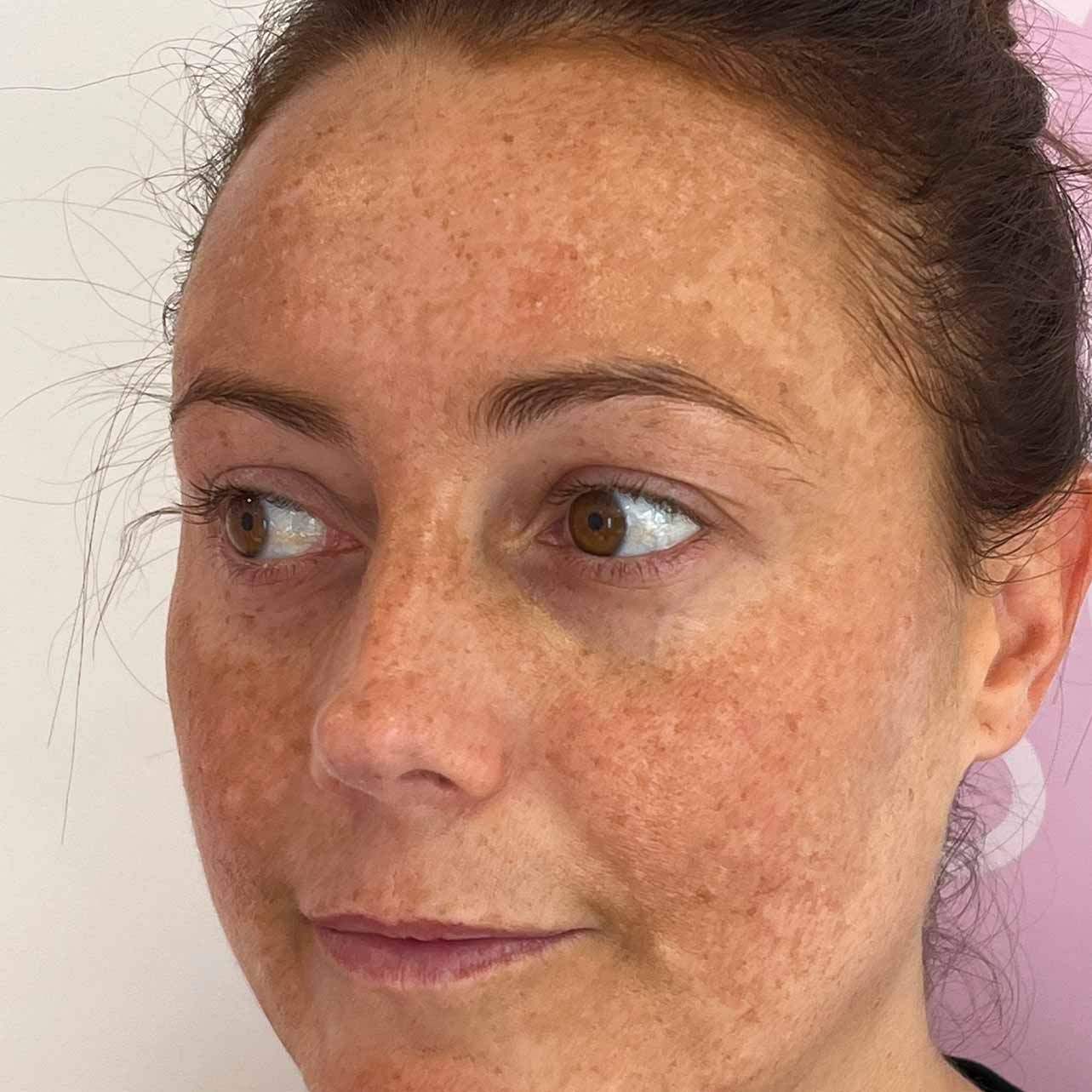 Before & After - Cardiff Permanent Makeup Studio