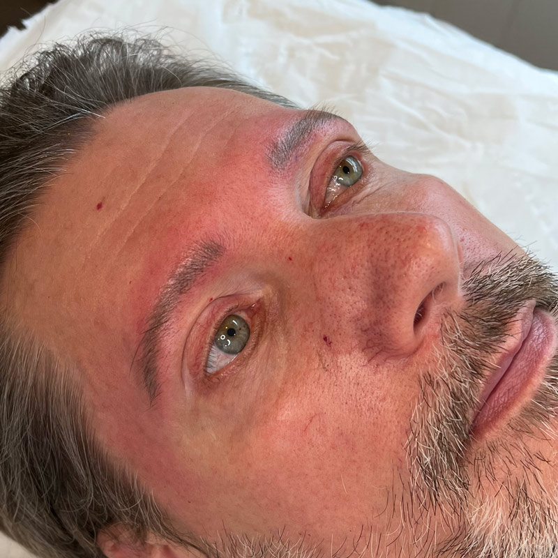 Before & After - Cardiff Permanent Makeup Studio